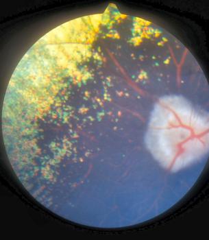 EYE CONDITIONS IN LABS RIOROCK LABS LABRADORS